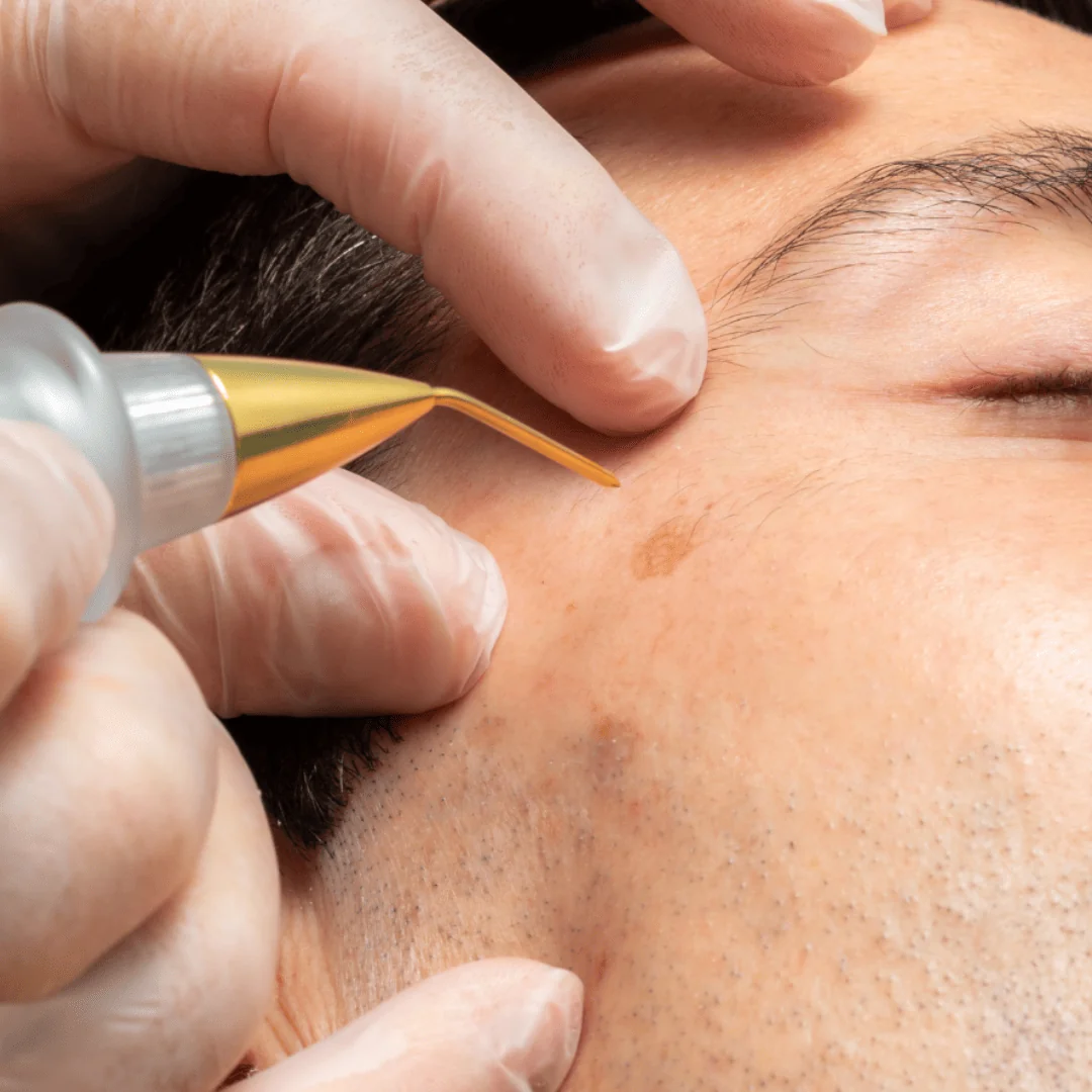 FibroBlast Michigan - Fine Strokes Microblading