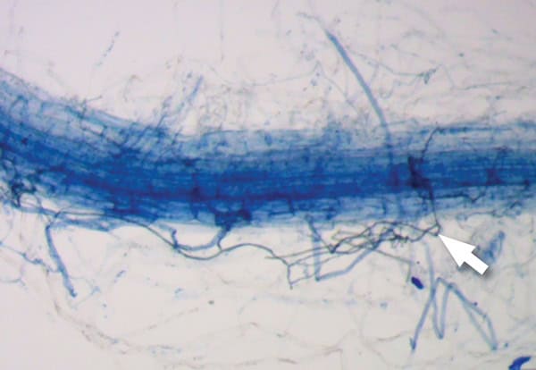 endomycorrhizae microscope