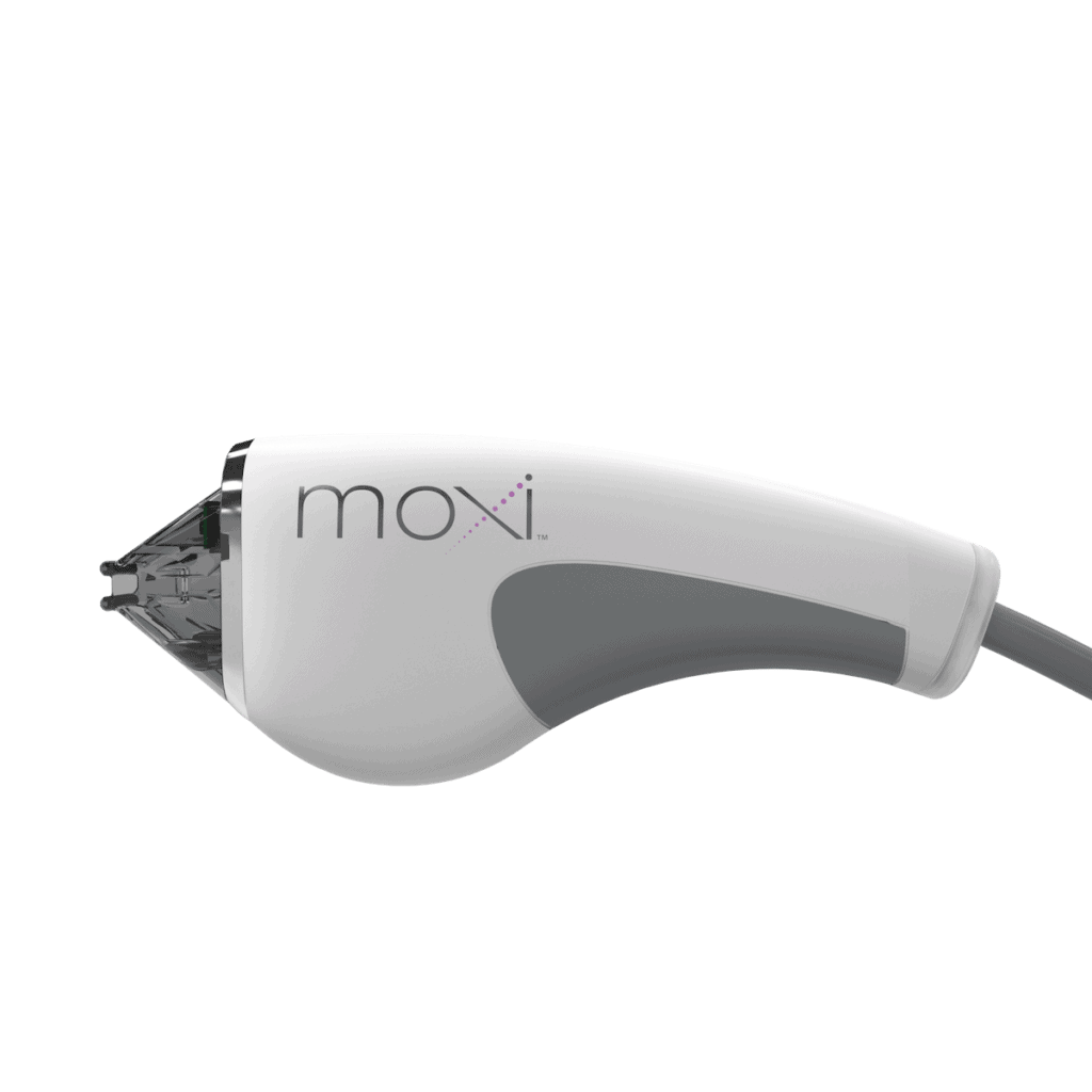 Moxi Laser Treatment