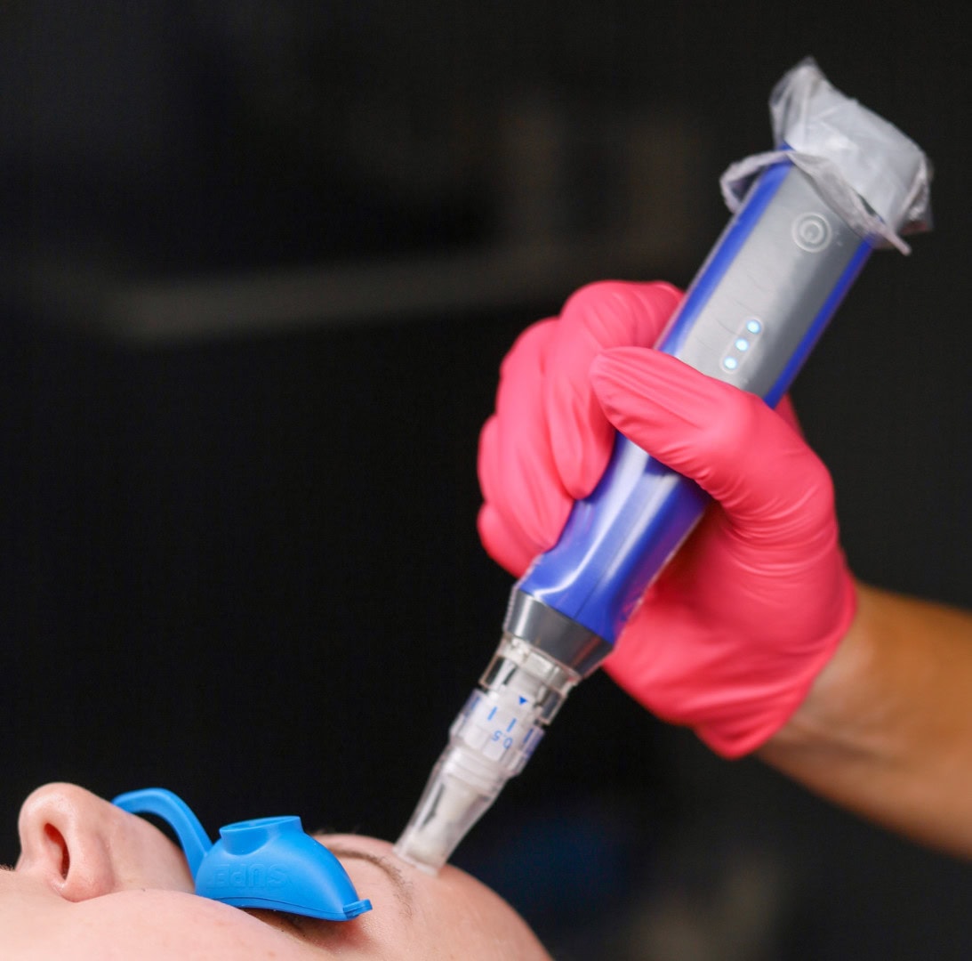 SkinPen® Microneedling - Current Facial Plastic Surgery & Medspa