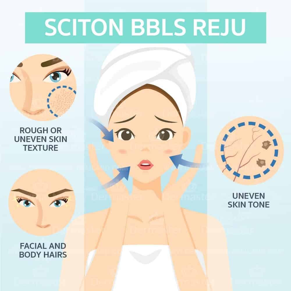 Sciton BBLs Reju Improve The Skin Appearance - Dermaster