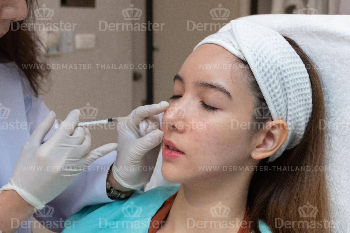 Meso F Lift Fat Removal Injection - Dermaster Beauty Clinic