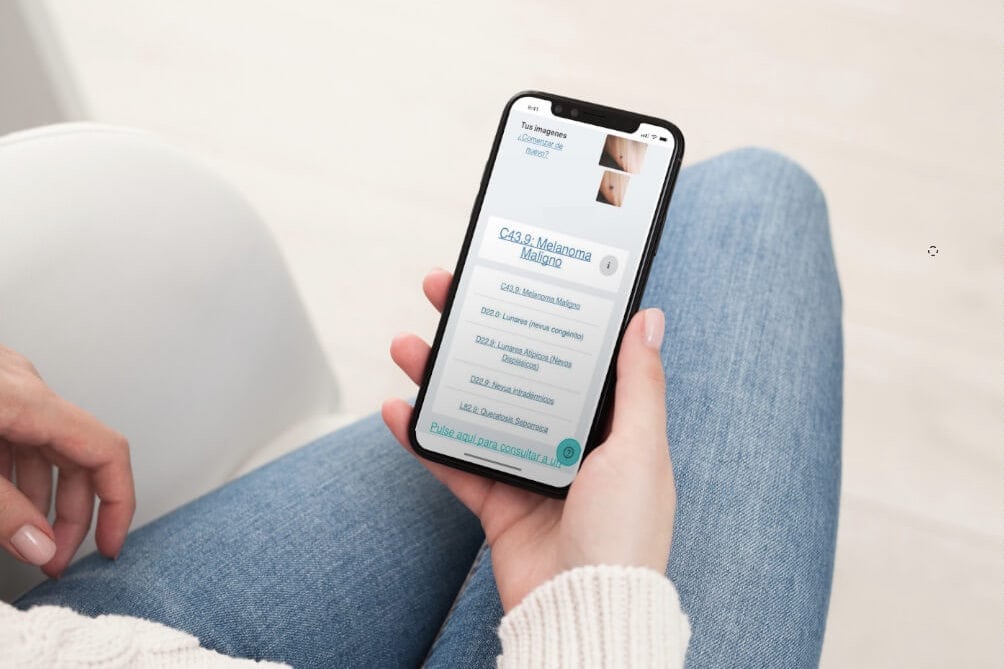 First Derm® llega a España identificando 33 enfermedades de la piel con ...