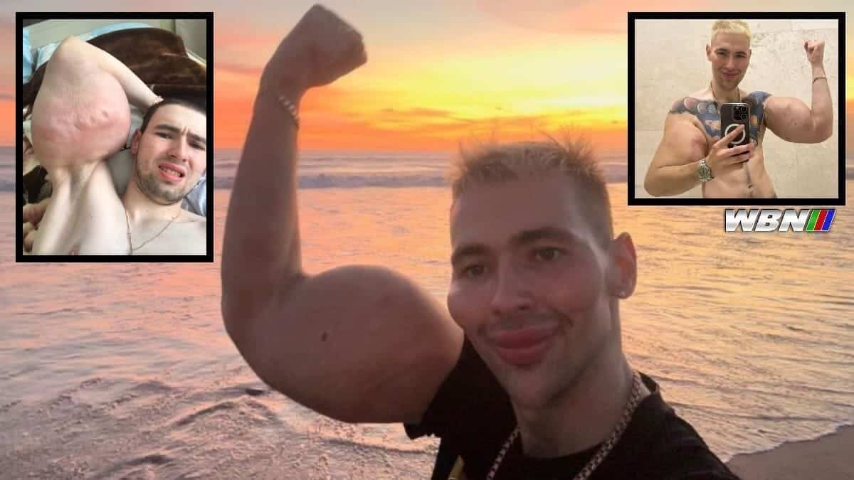 'Bazooka' boxer with 1.5 gallon injected 26-inch biceps fights on - World Boxing News