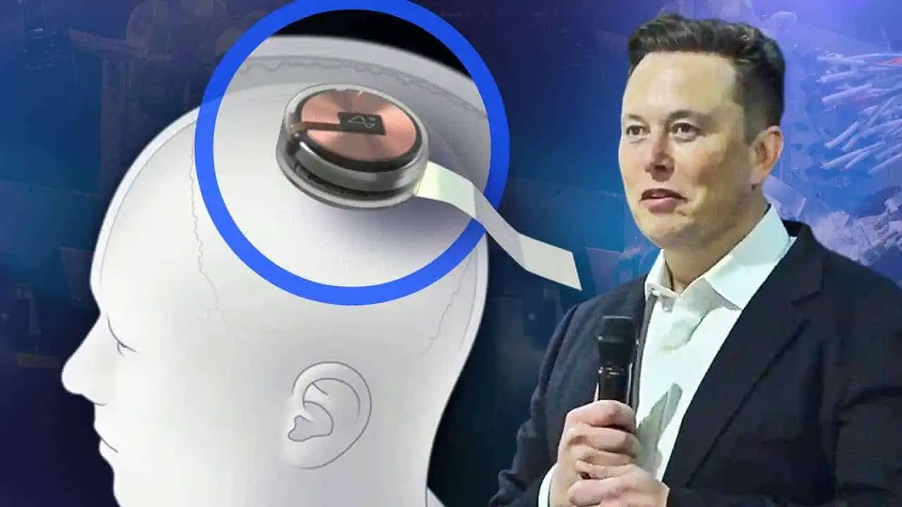 Elon Musk's Neuralink N1 FDA Approves For Human Trials, How? Elon Musk's Neuralink N1 FDA Approves For Human Trials, How?